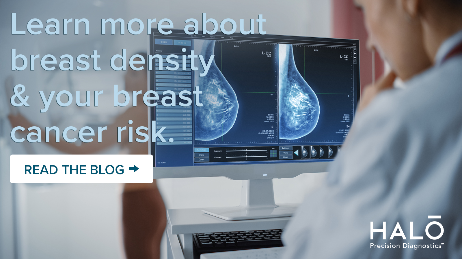 The Various Levels Of Breast Density Halo Precision Diagnostics