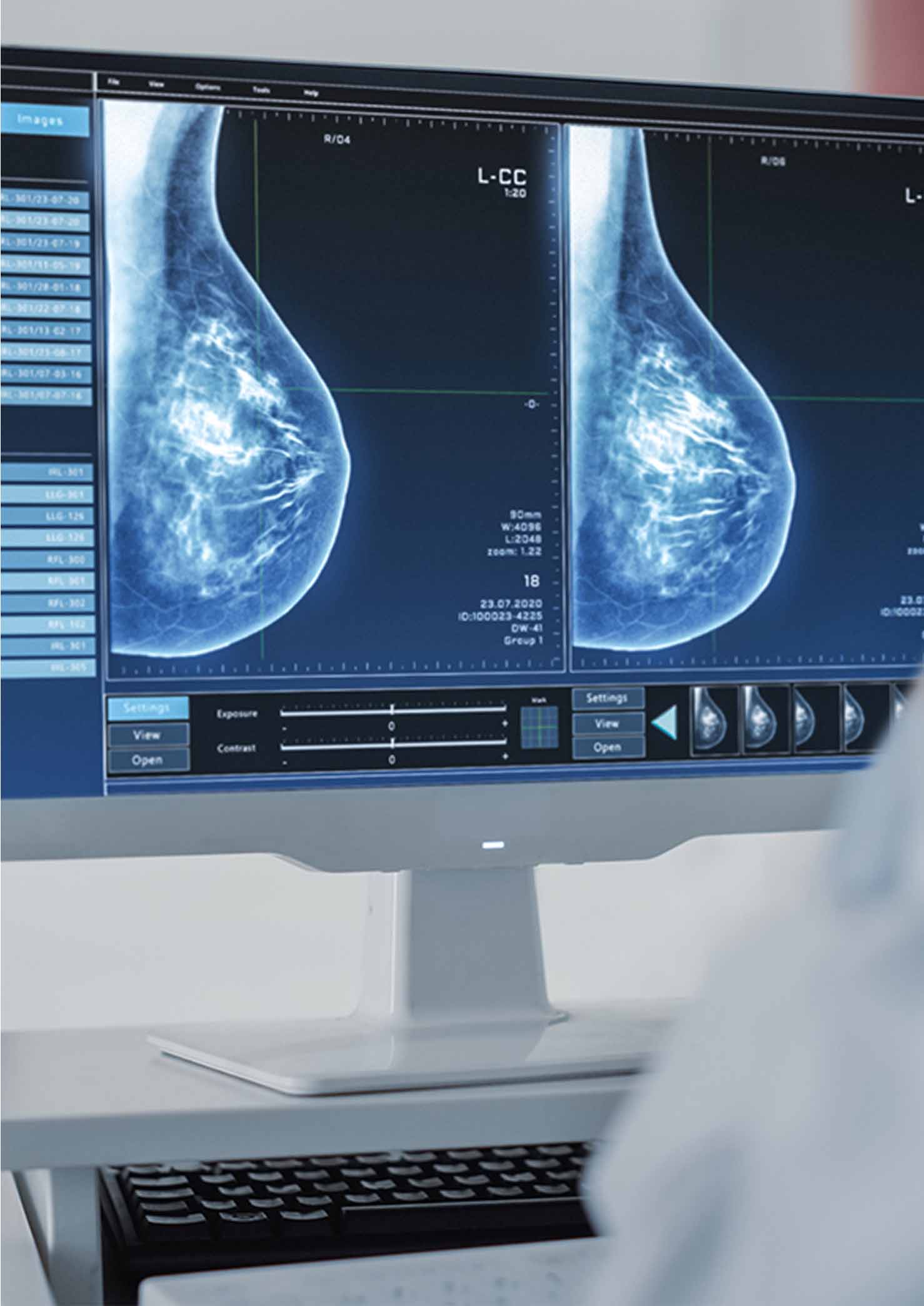 Genetic health | HALO Precision Diagnostics